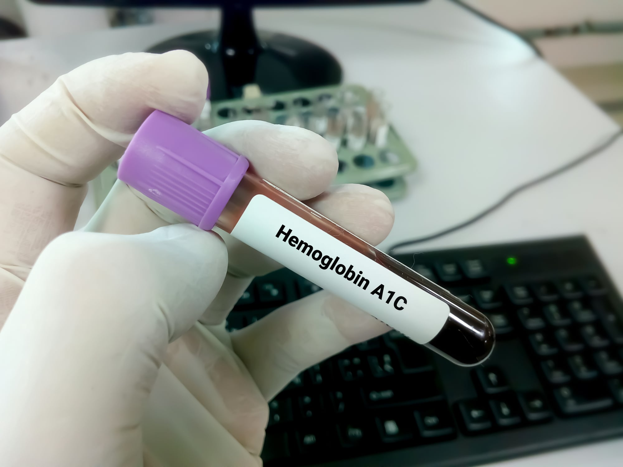How to interpret A1C results at different ages - MediaFeed